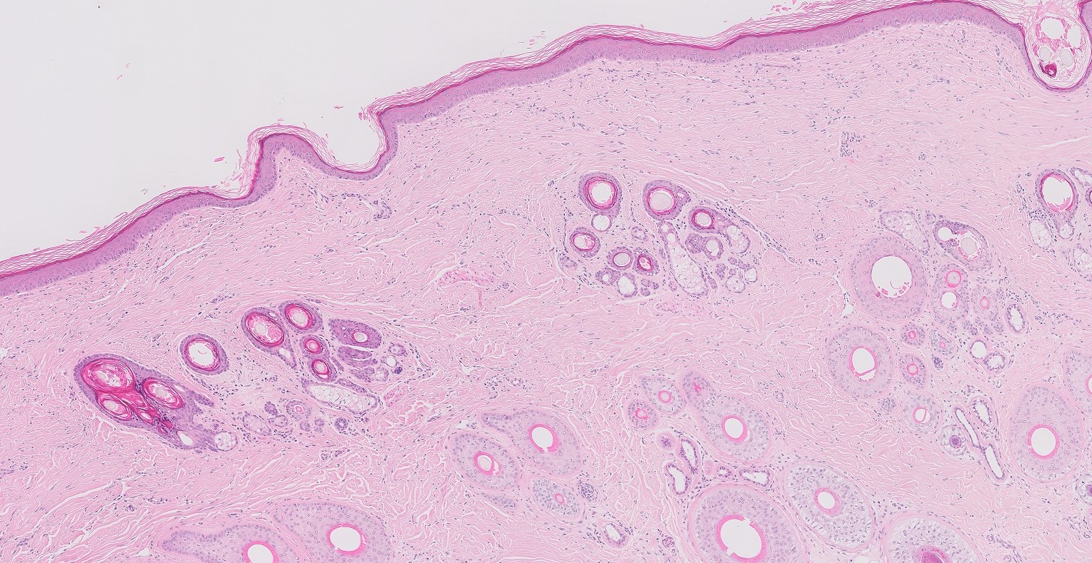 Reference Guide to Special Stains – Finn Pathologists