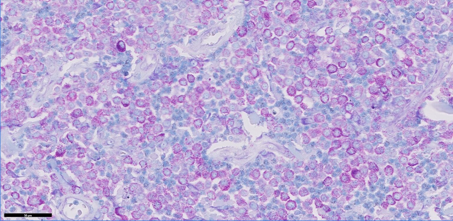 Reference Guide to Special Stains – Finn Pathologists