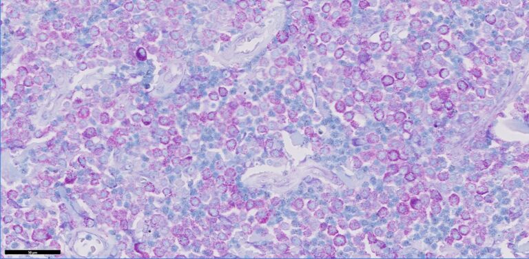 Reference Guide to Special Stains – Finn Pathologists