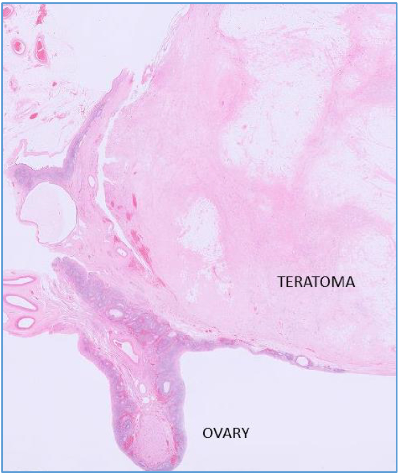 Organ of the Month: PART I – The Female Reproductive Tract – Finn ...
